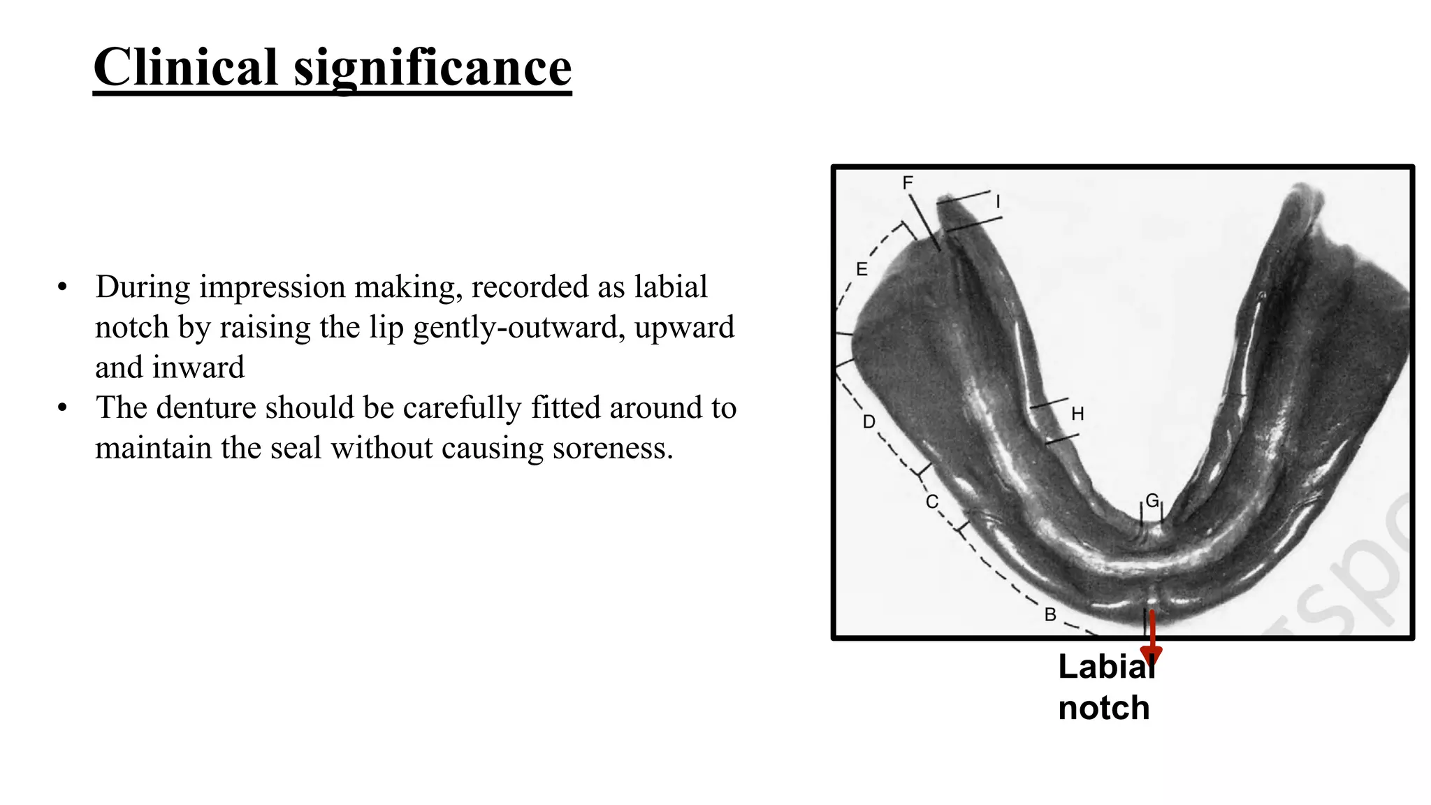 Landmarks of mandible | PPTX