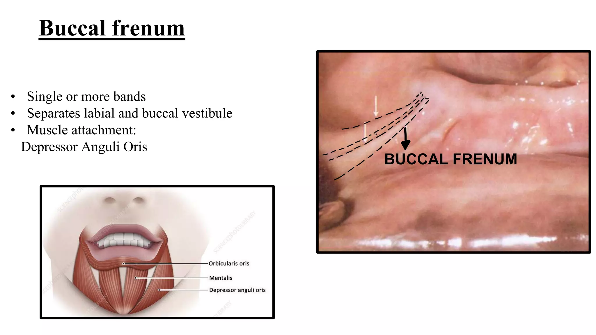 Landmarks of mandible | PPTX