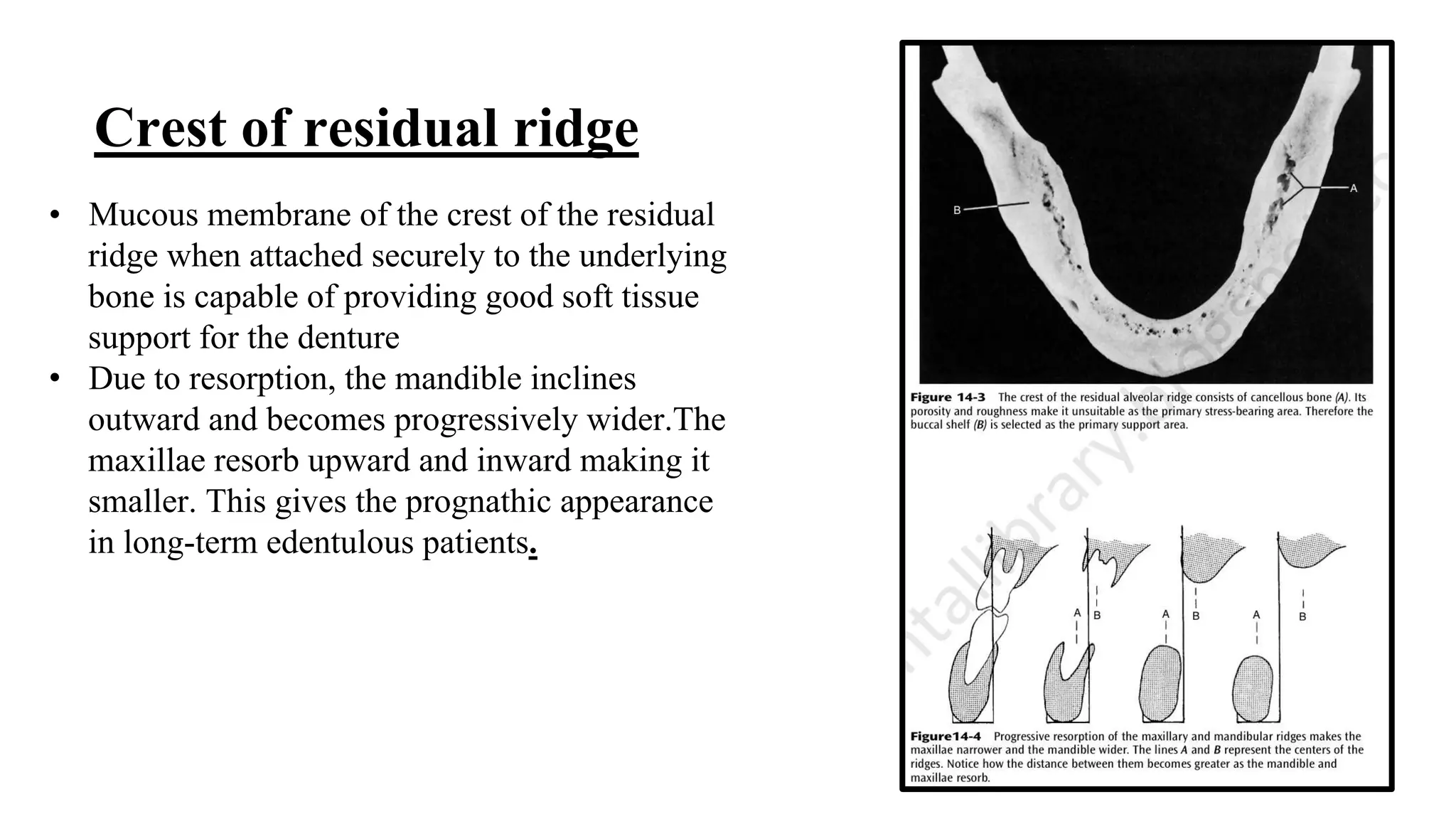 Landmarks of mandible | PPTX