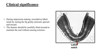 Landmarks of mandible | PPTX