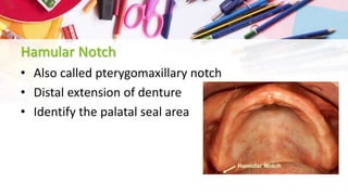 Landmarks of maxilla | PPT