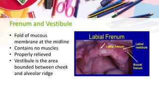 Landmarks of maxilla | PPT