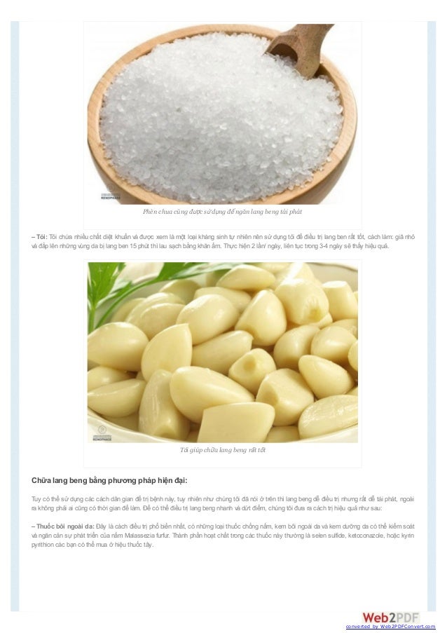 Lang beng - Những nguyên nhân và cách điều trị dứt điểm