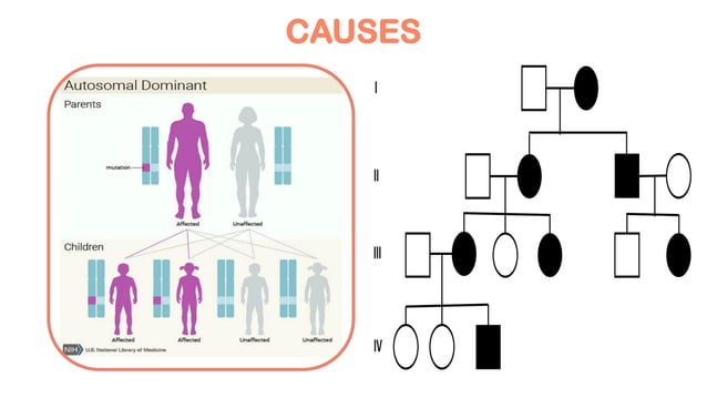 LANGER GIEDION SYNDROME | PDF | Genetics | Science