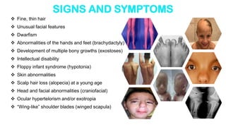 LANGER GIEDION SYNDROME | PDF