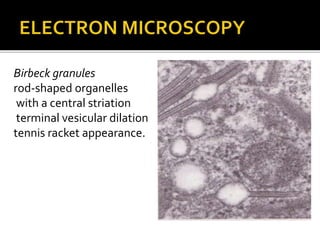 Langerhans cell histiocytosis | PPTX