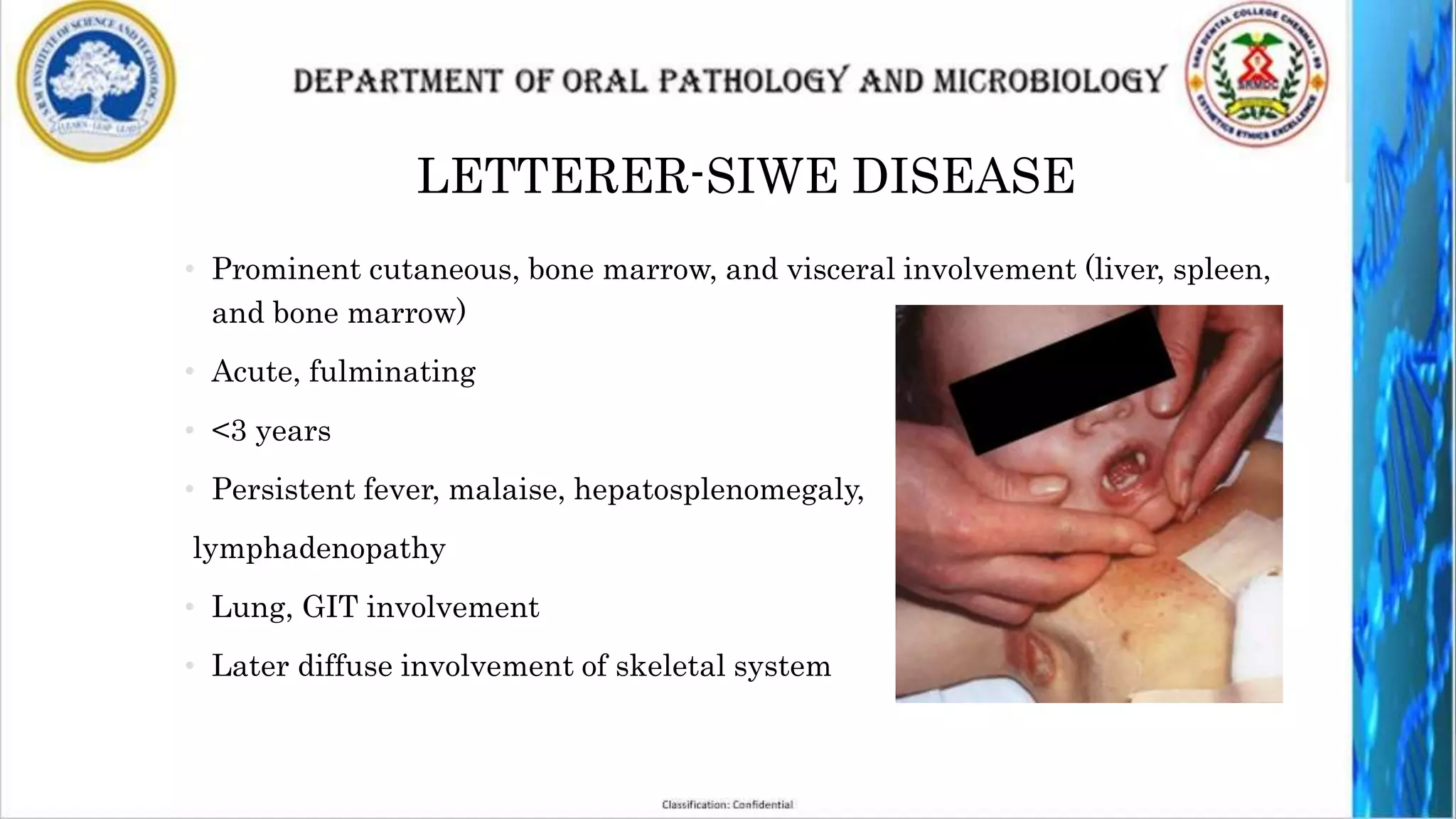 Langerhans cell histiocytosis & Myofacial pain dysfunction syndrome | PPTX
