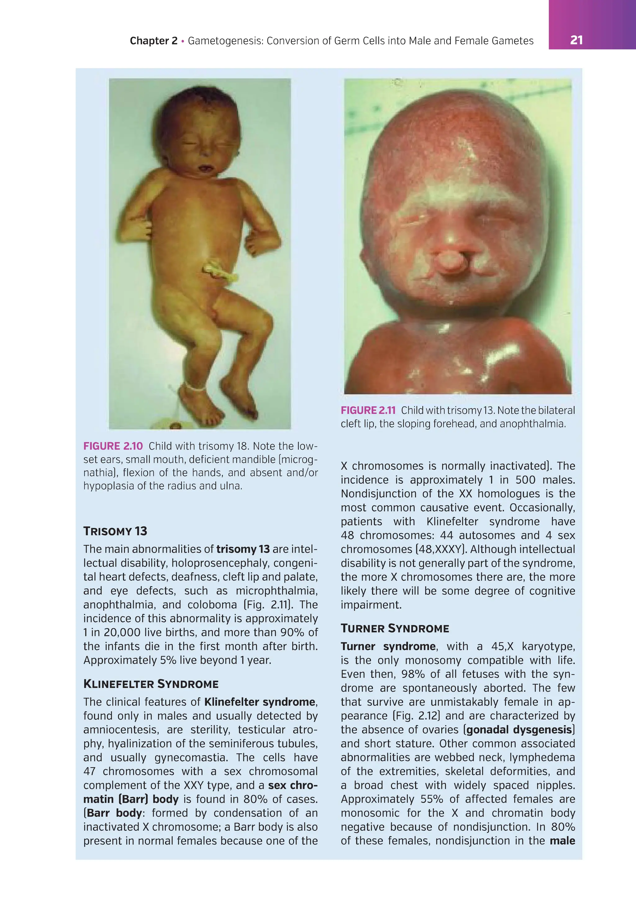 Langman's Medical Embryology 14th Ed.pdf