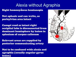 Language disorders | PPT