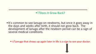 Lanugo ( baby with thin hair on there bodies )- a detailed medical ...