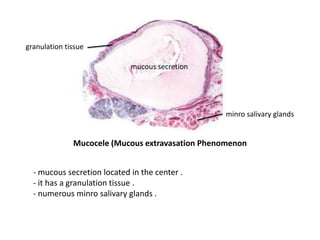 pathology Lap | PPTX | Bone and Joint Conditions | Diseases and Conditions
