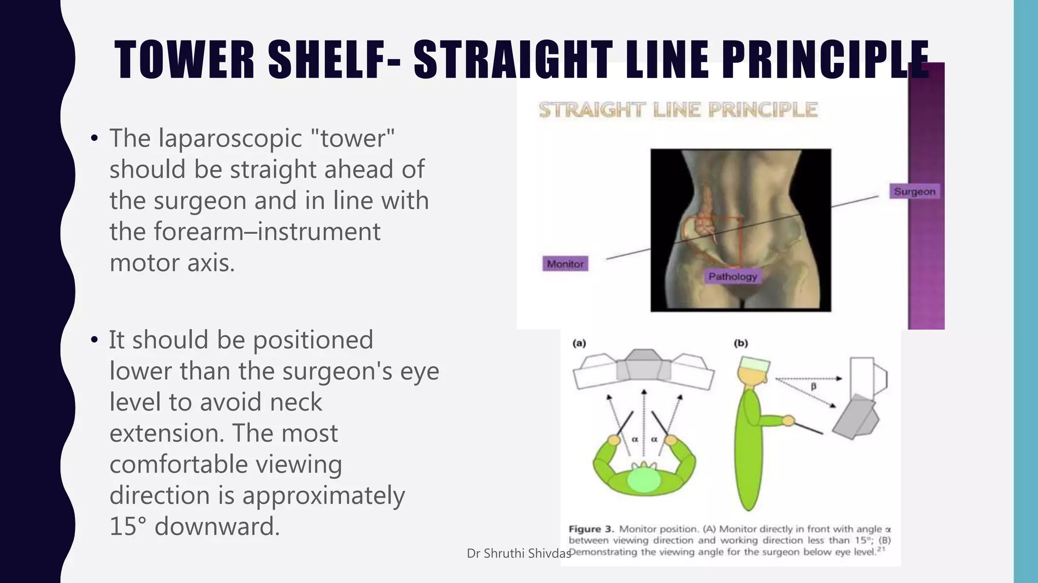 Basics of Laparoscopy Gyn | PPTX