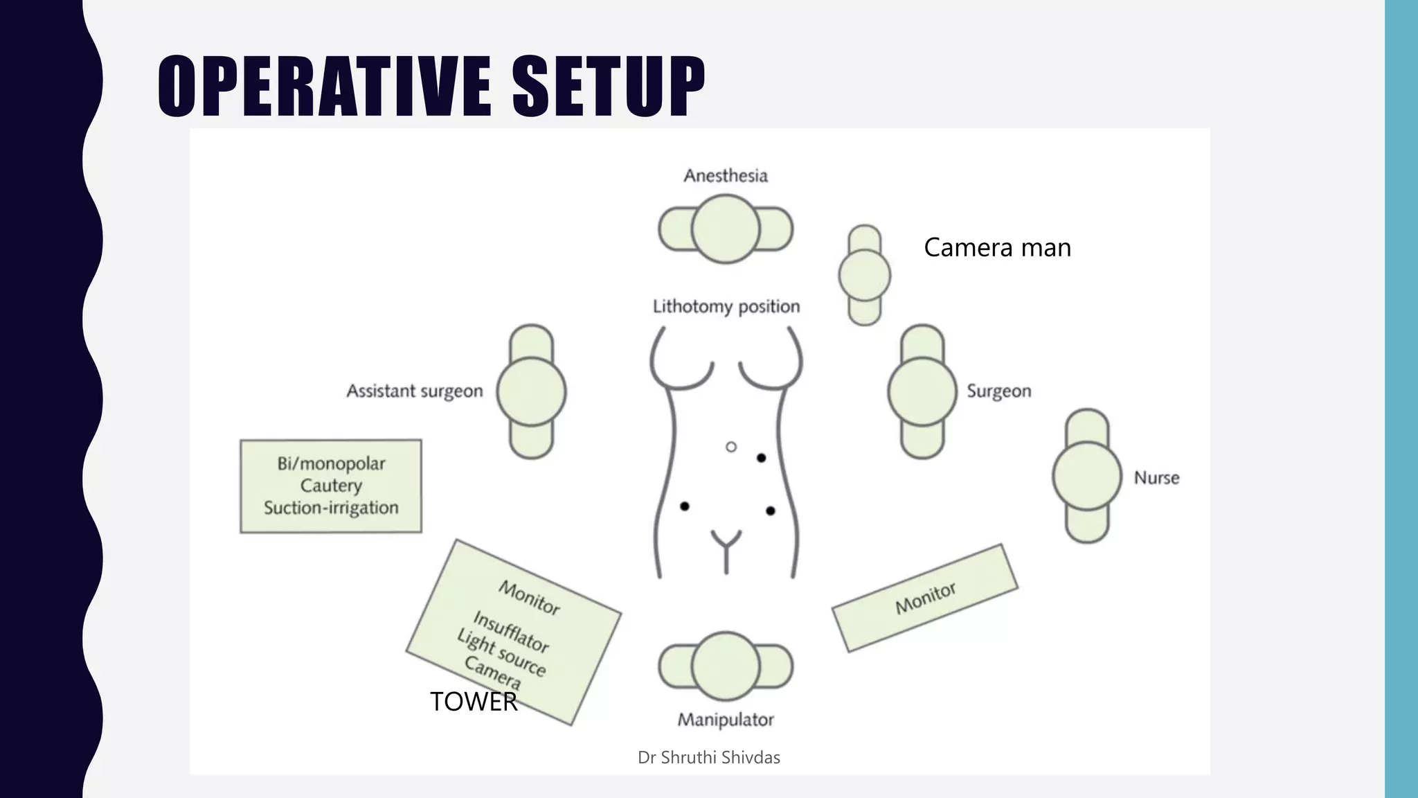 Basics of Laparoscopy Gyn | PPTX