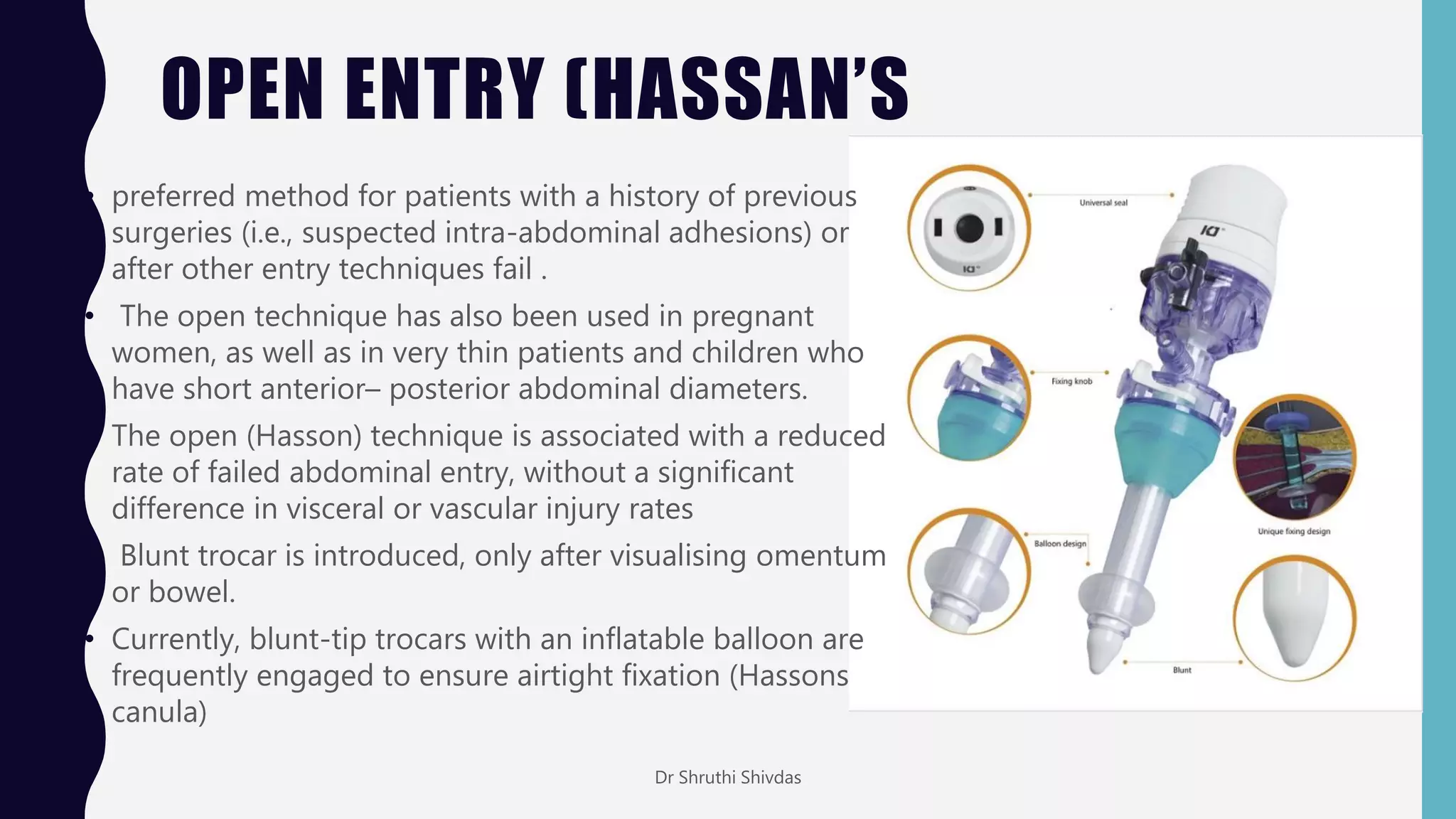 Basics of Laparoscopy Gyn | PPTX