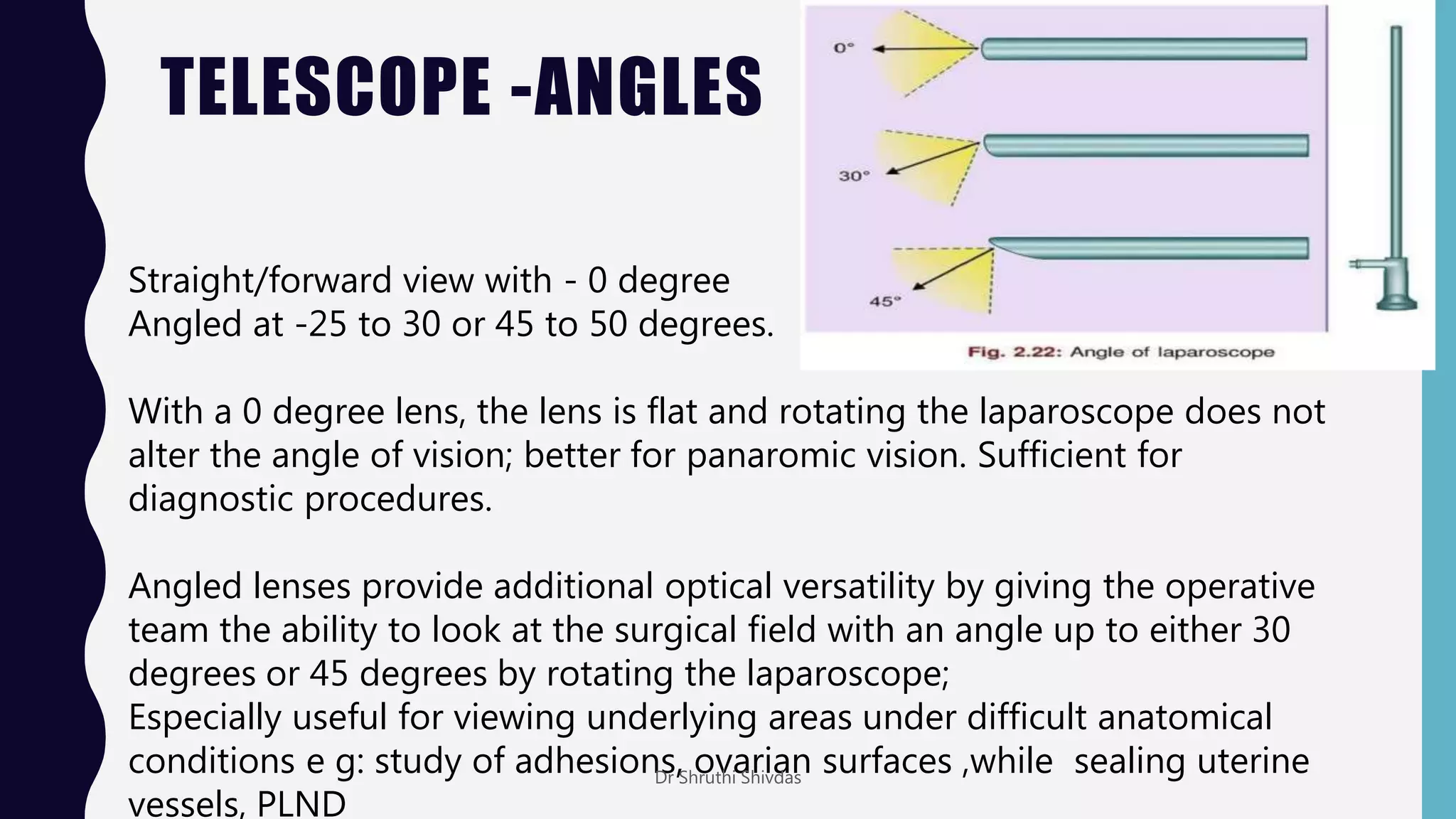 Basics of Laparoscopy Gyn | PPTX