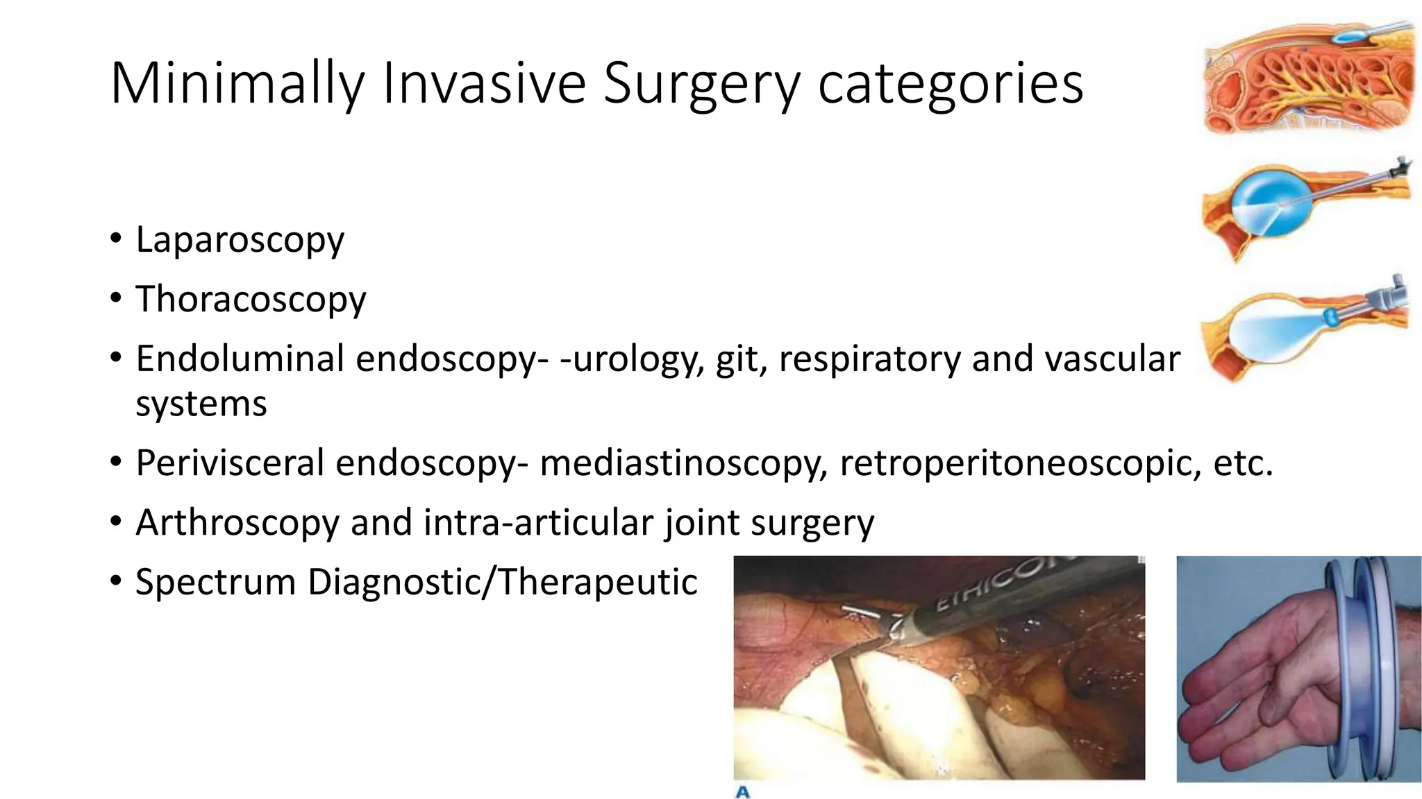 laparoscopic and robotic surgery ma.pptx