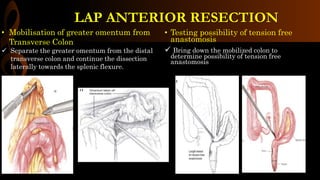 LAP ANTERIOR RESECTION-STEP BY STEP Operative Surgery.pptx
