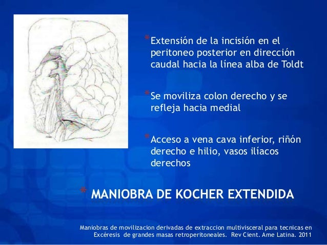 Laparatomia exploradora