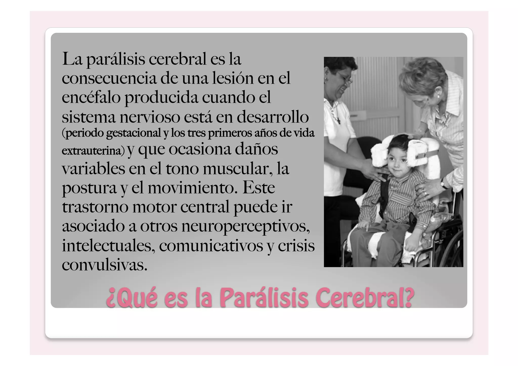 La parálisis cerebral infantil | PPT