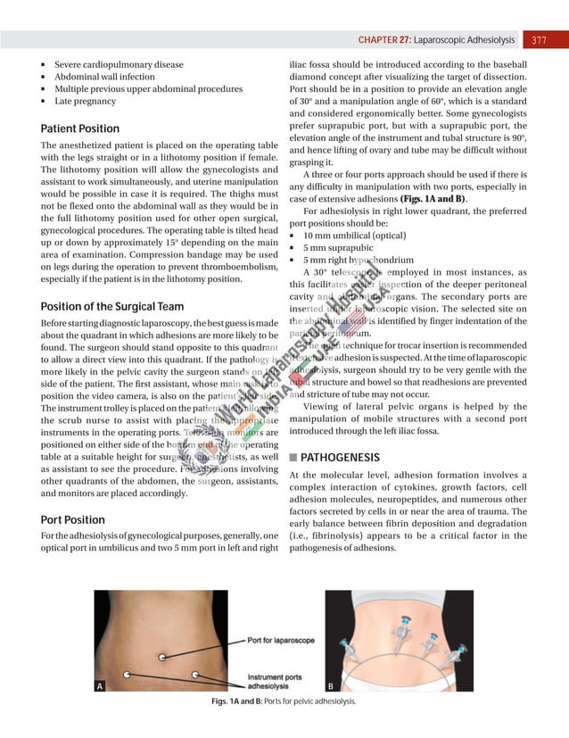 Laparoscopic Adhesiolysis | PDF