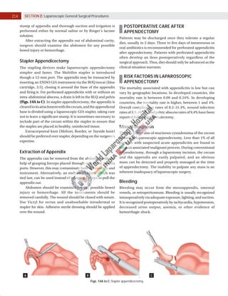 Laparoscopic Appendicectomy | PDF | Digestive Disorders | Diseases and ...