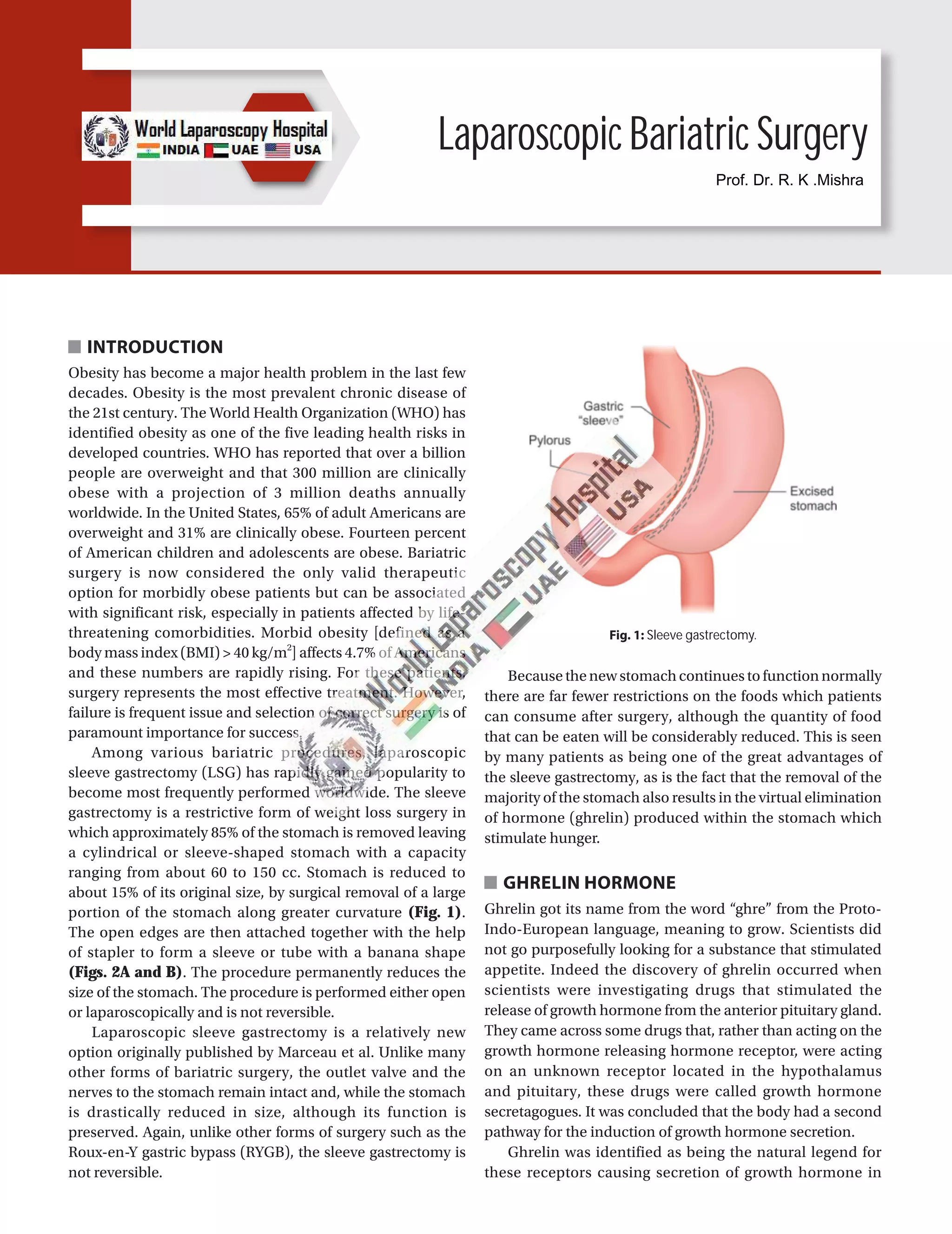 Laparoscopic Bariatric Surgery | PDF