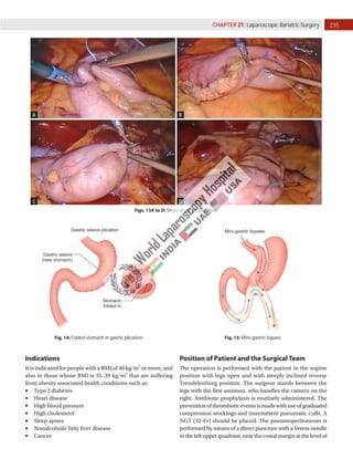Laparoscopic Bariatric Surgery | PDF