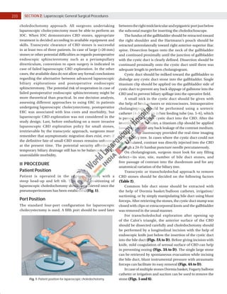 Laparoscopic CBD Exploration | PDF