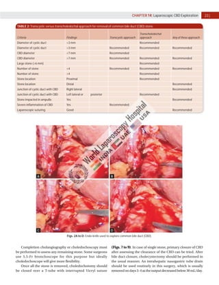 Laparoscopic CBD Exploration | PDF