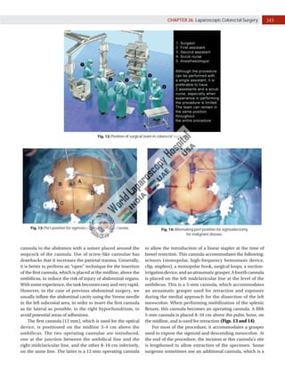 Laparoscopic Colorectal Surgery | PDF