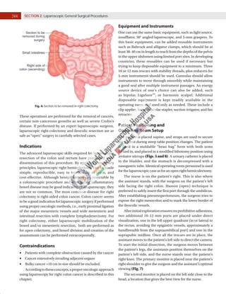 Laparoscopic Colorectal Surgery | PDF