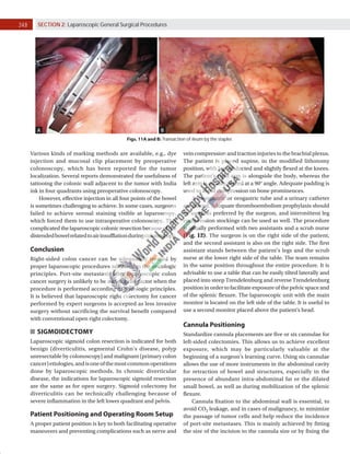 Laparoscopic Colorectal Surgery | PDF