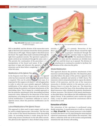 Laparoscopic Colorectal Surgery at WLH Hospital | PDF