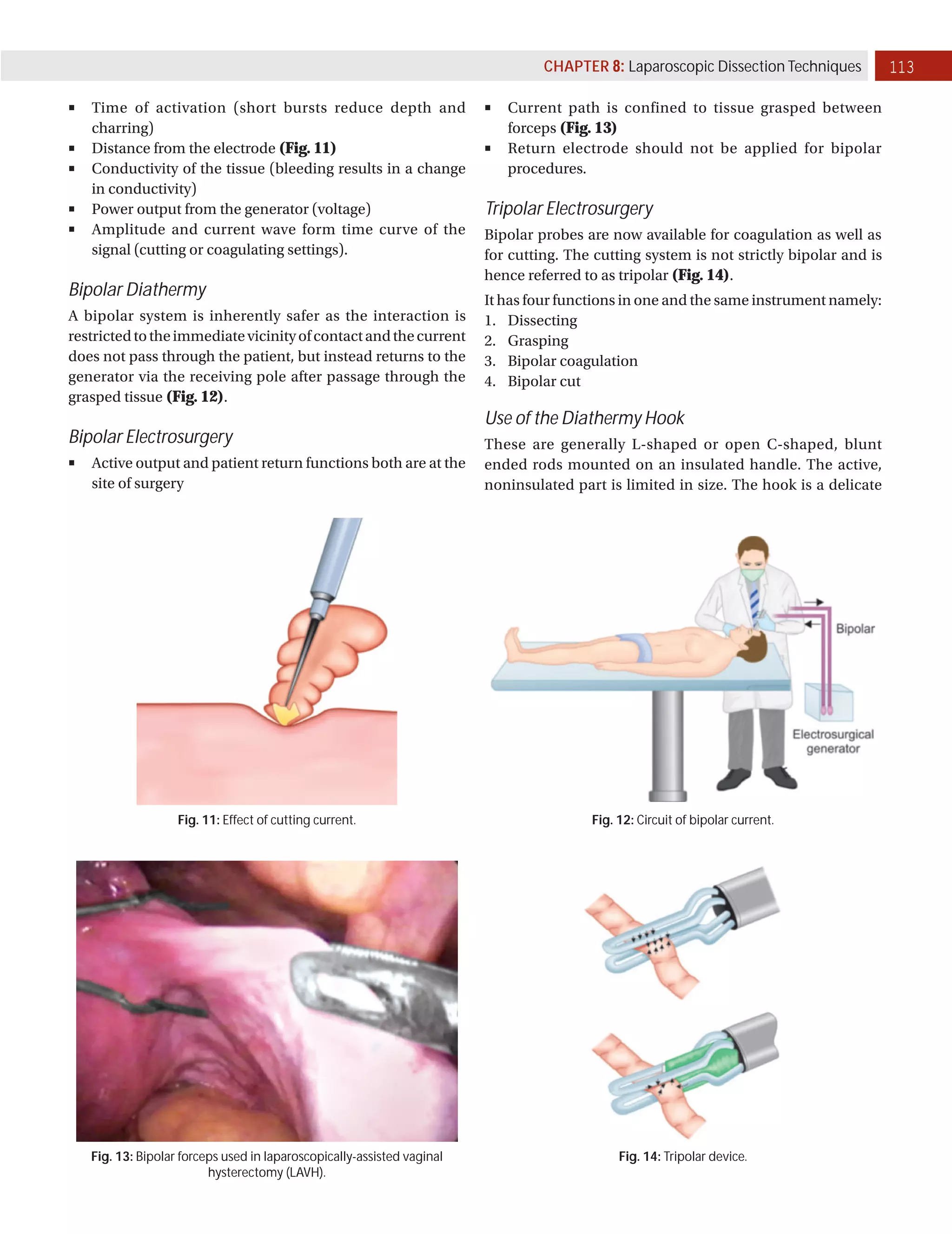 Laparoscopic Dissection Techniques | PDF