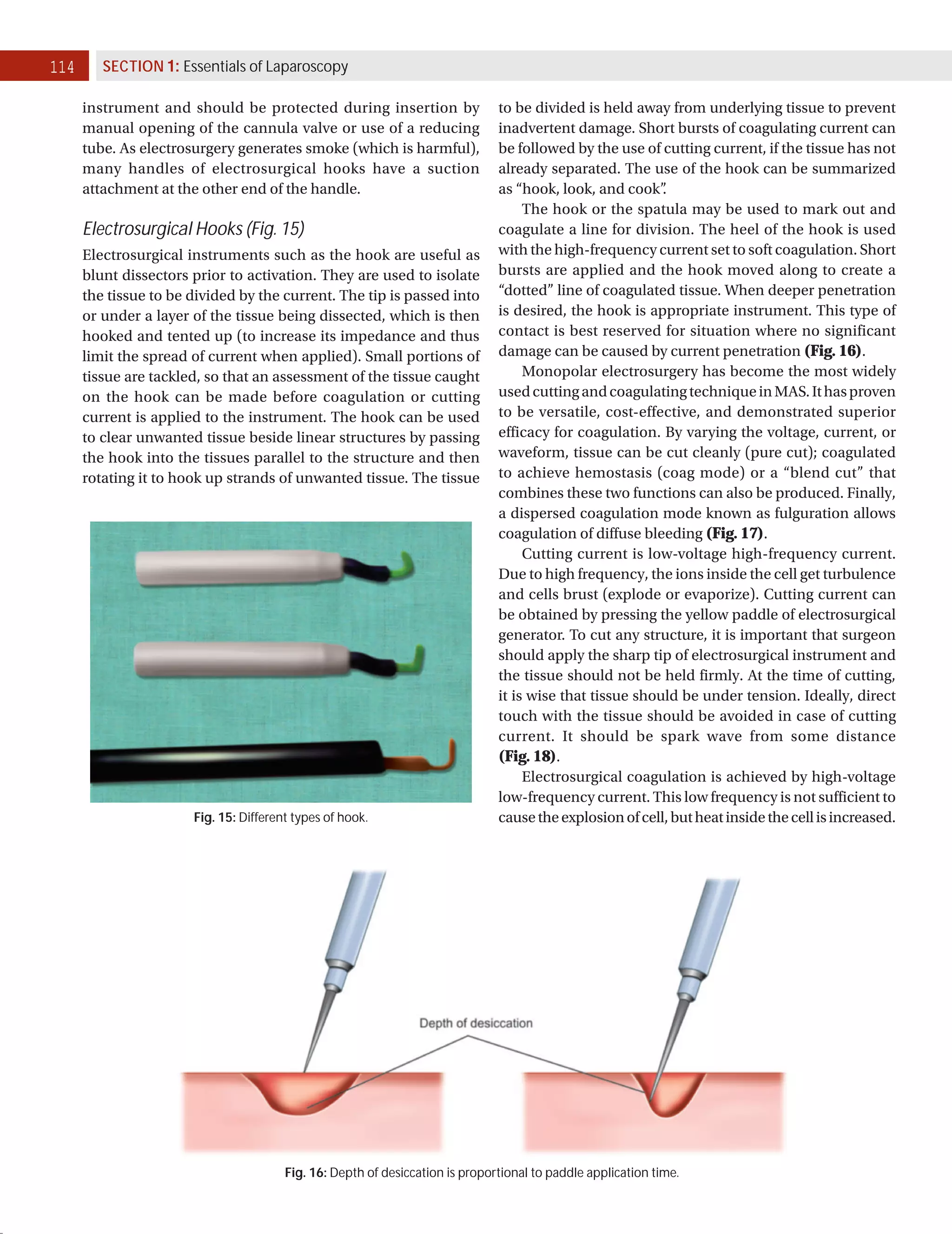 Laparoscopic Dissection Techniques | PDF