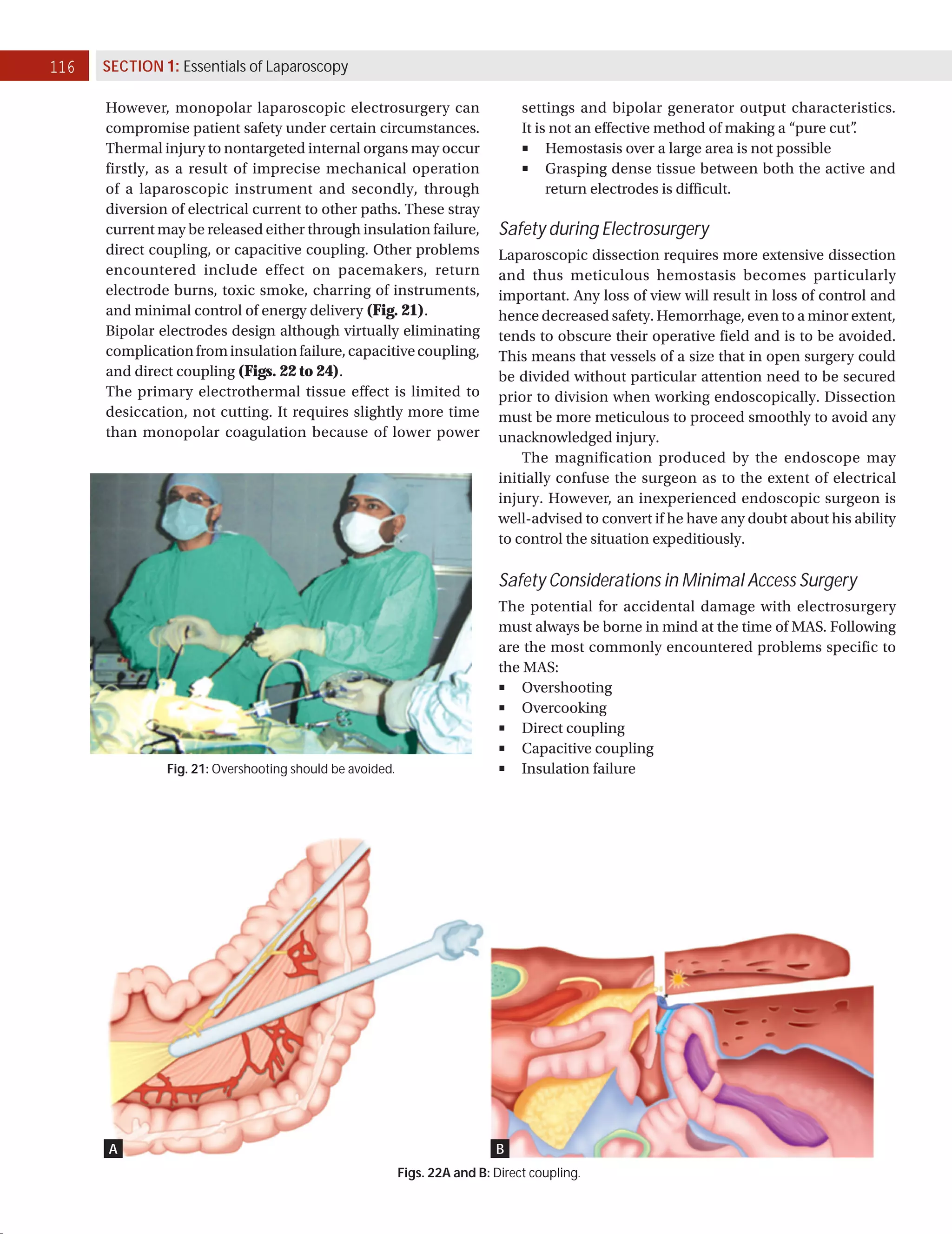 Laparoscopic Dissection Techniques | PDF