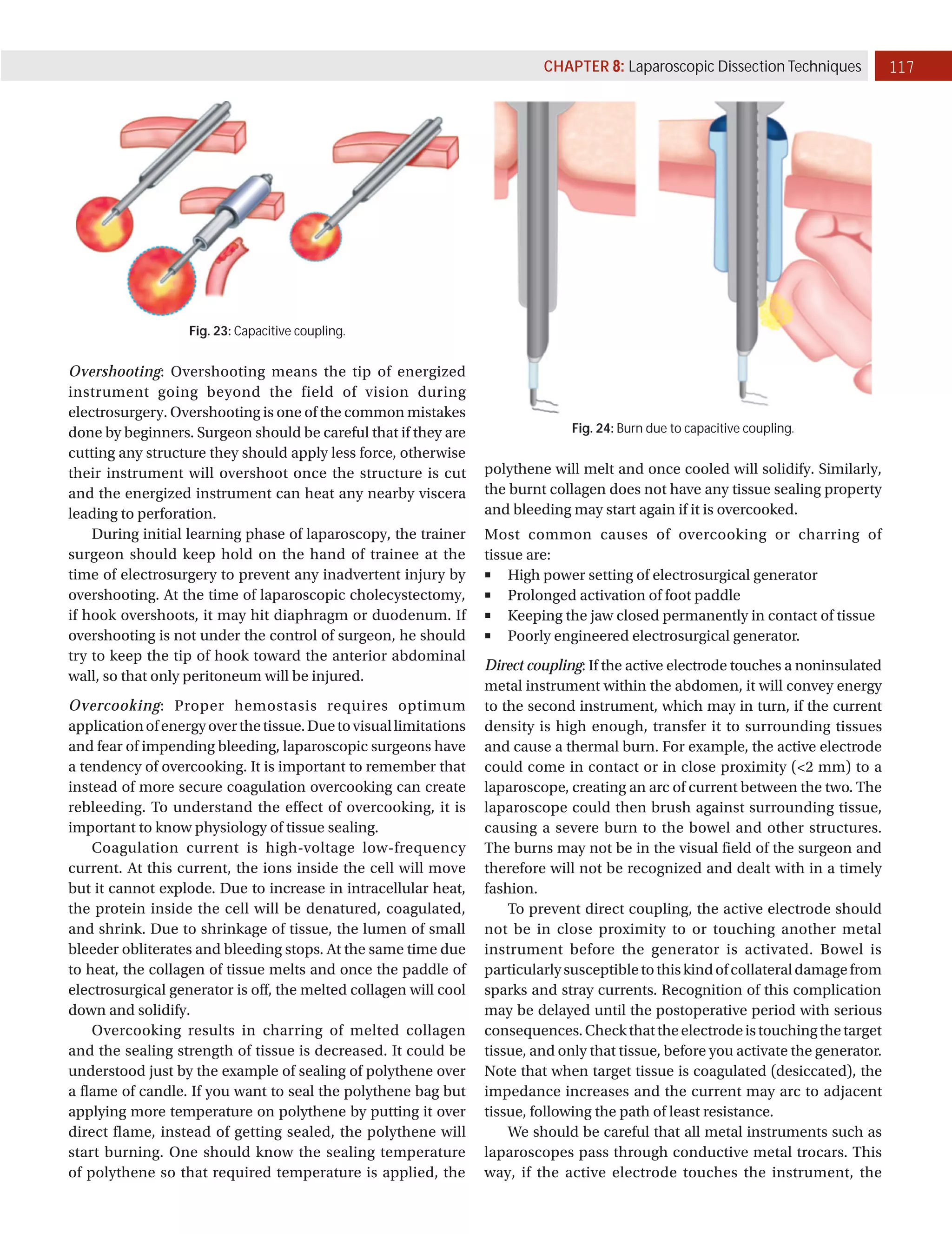 Laparoscopic Dissection Techniques | PDF