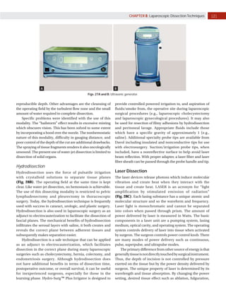 Laparoscopic Dissection Techniques | PDF