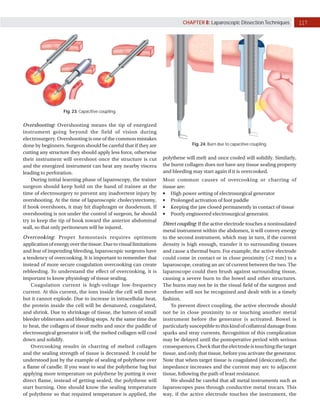 Laparoscopic Dissection Techniques | PDF