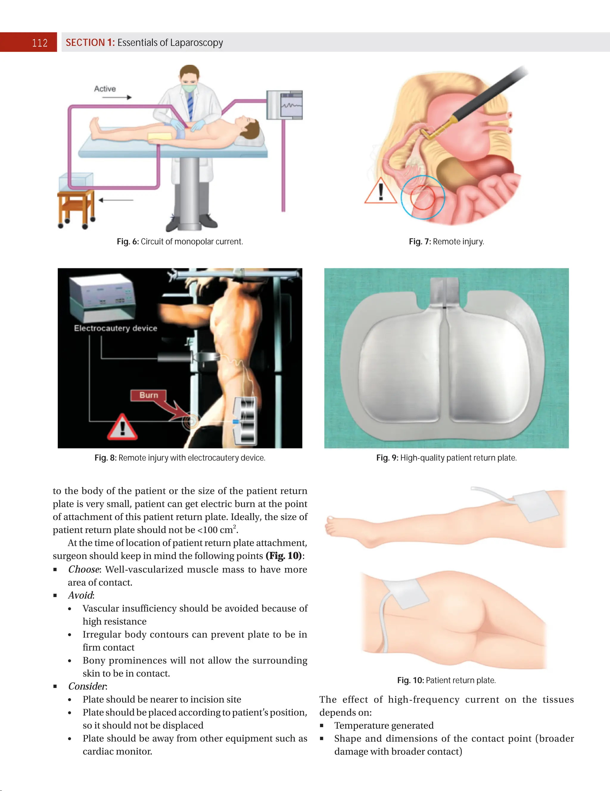Laparoscopic Dissection Techniques at WLH | PDF