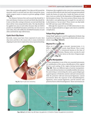 Laparoscopic Equipment and Instruments | PDF