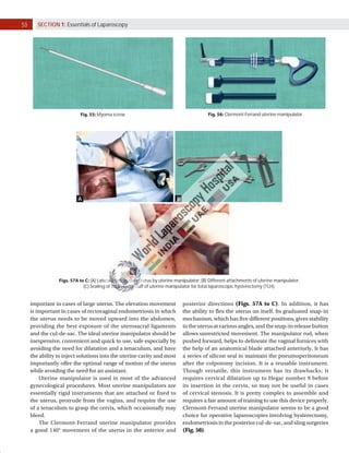 Laparoscopic Equipment and Instruments | PDF