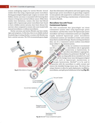 Laparoscopic Equipment and Instruments | PDF