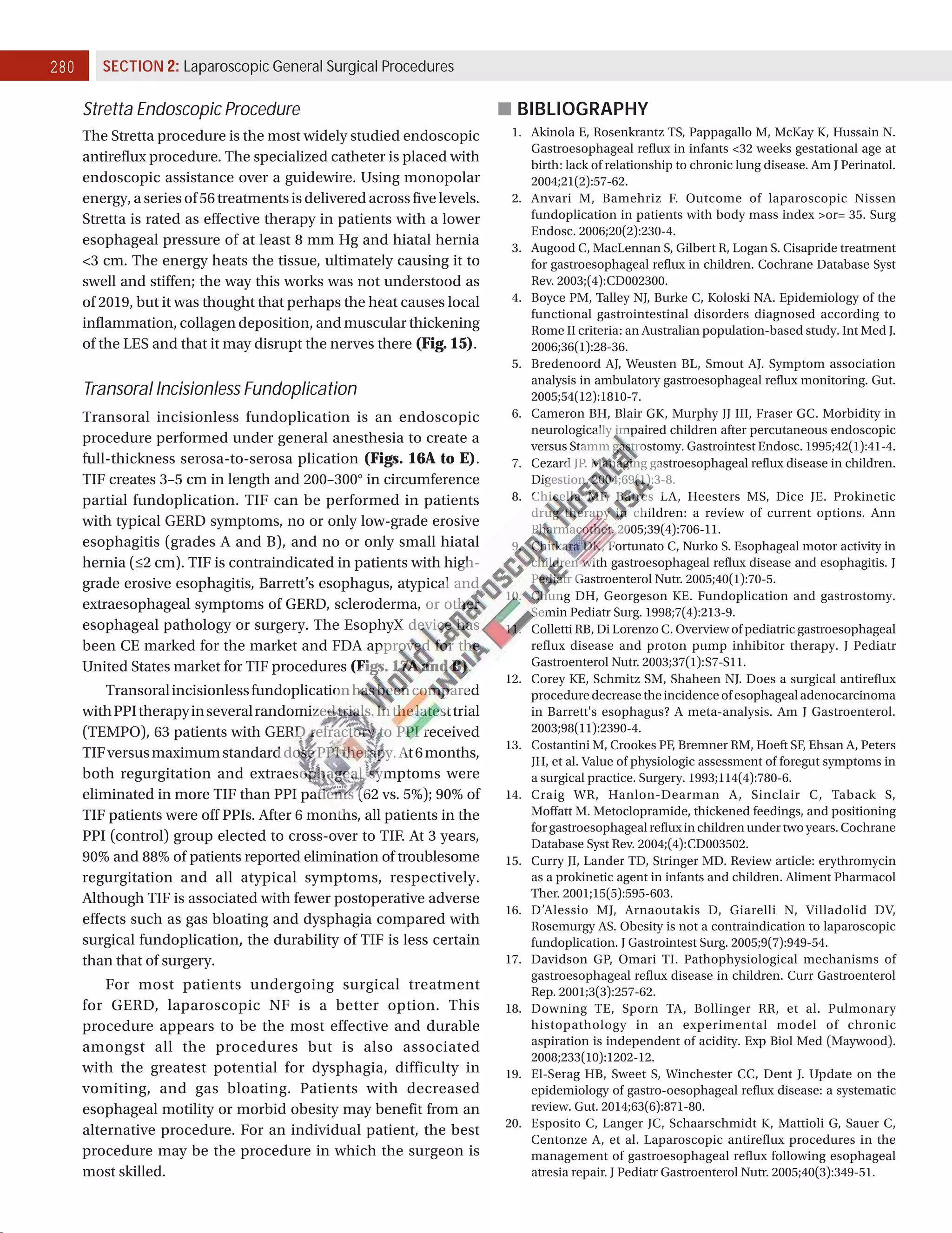 Laparoscopic Fundoplication | PDF