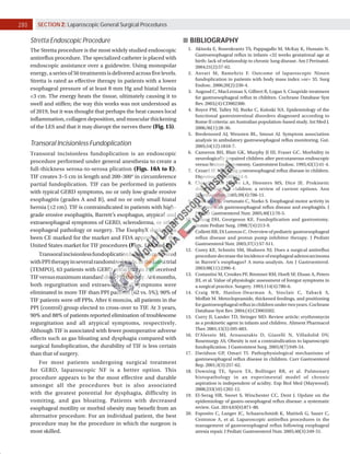 Laparoscopic Fundoplication at World Laparoscopy Hospital | PDF