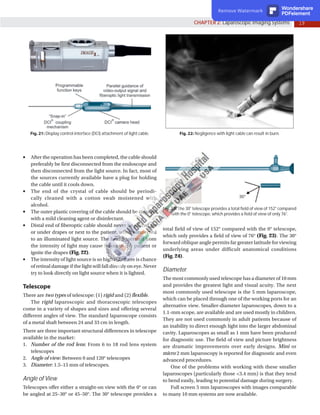 Laparoscopic Imaging Systems at World Laparoscopy Hospital | PDF