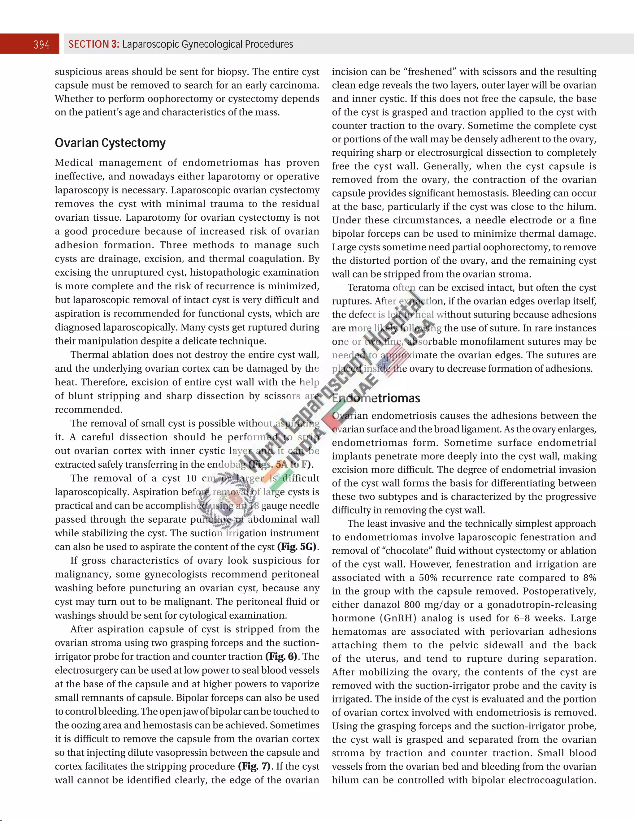 Laparoscopic Ovarian Surgery | PDF
