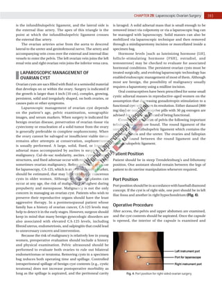 Laparoscopic Ovarian Surgery | PDF
