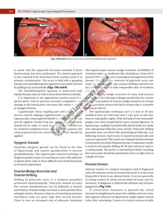 Laparoscopic Ovarian Surgery | PDF