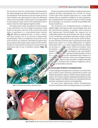Laparoscopic Pediatric Surgery at World Laparoscopy Hospital | PDF